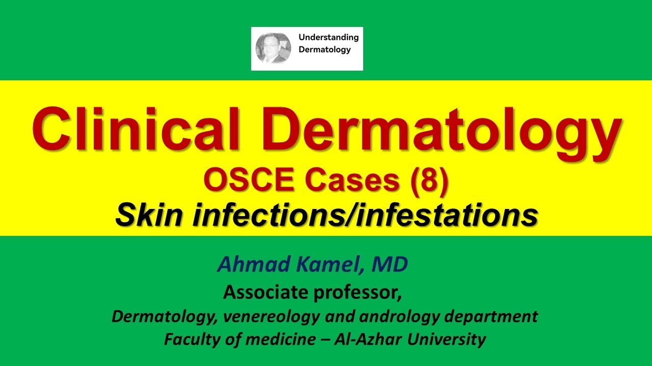 Clinical Dermatology OSCE Cases 8 Skin Infections and Infestations ...