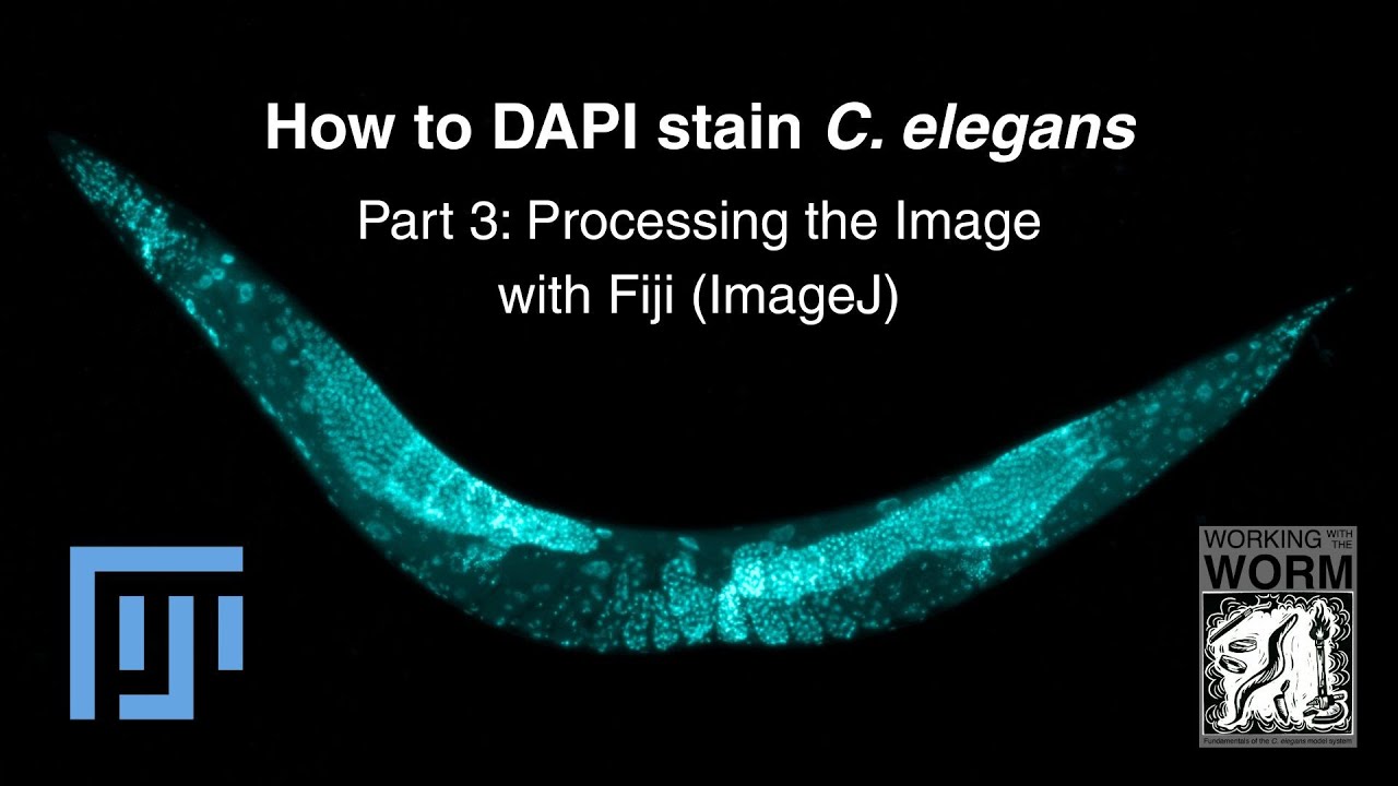 How to DAPI stain C. elegans Part 3: Processing the image with FIJI ...