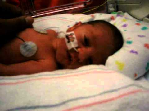 PPROMChance 32 Week Preemie - YouTube