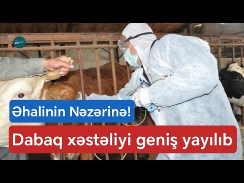 TƏCİLİ XƏBƏRDARLIQ! - Dabaq xəstəliyi genişlənir - Mütəxəssislər ...