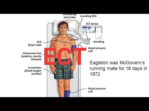 Mental Health Nursing, Topic-Electroconvulsive Therapy ( ECT) part - 2 ...