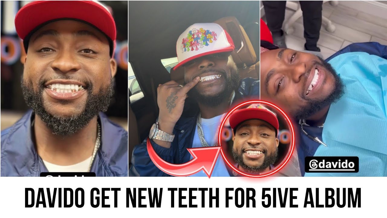 Davido Gets New Teeth For His 5ive Album As He Will Be Dropping New ...
