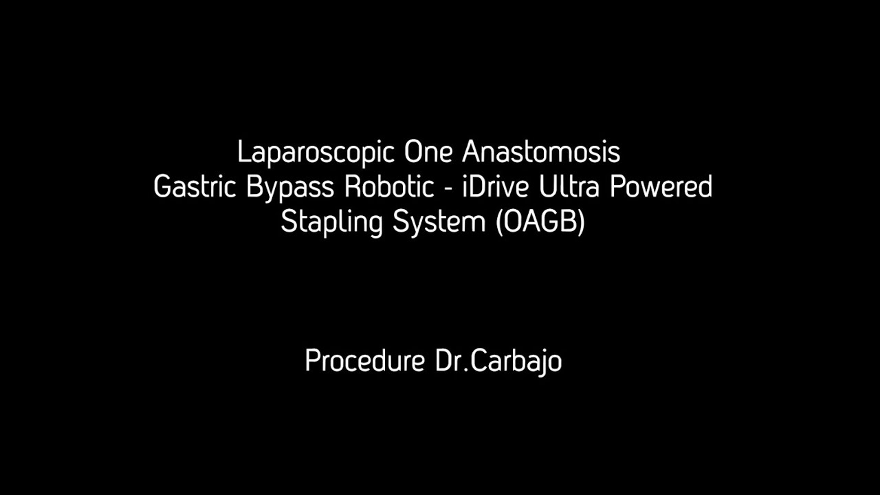 iDrive Ultra Powered Stapling System (OAGB) – Laparoscopic One ...