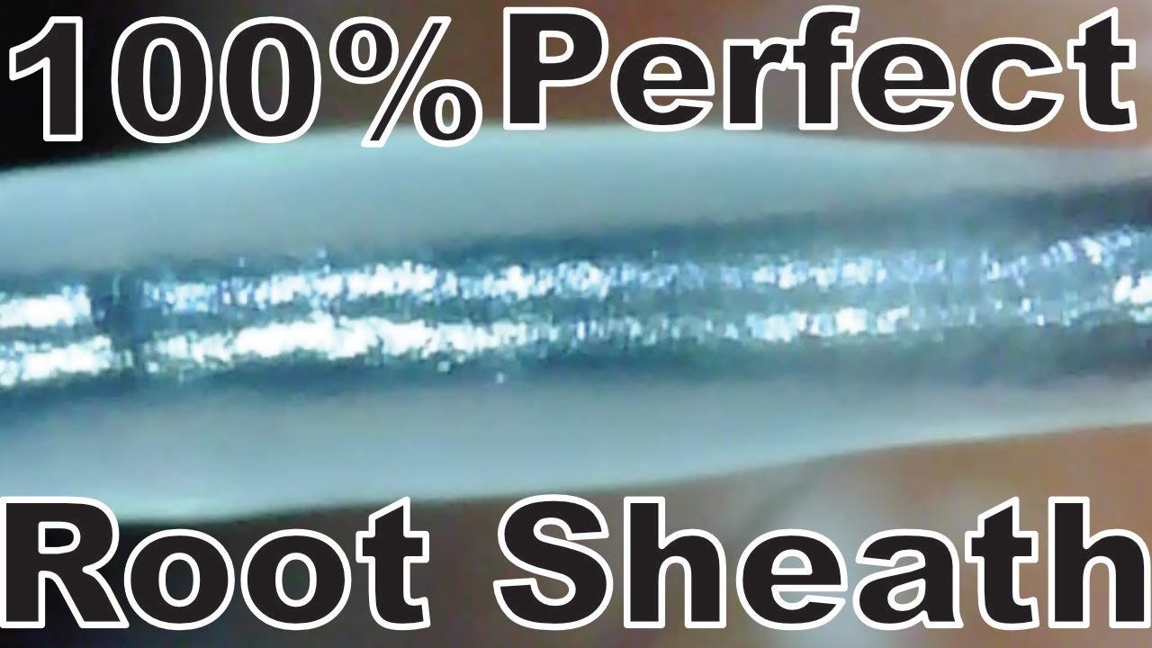 Hair Root Close-Up Part.31 100%毛根鞘【Perfect Root Sheath】 - YouTube