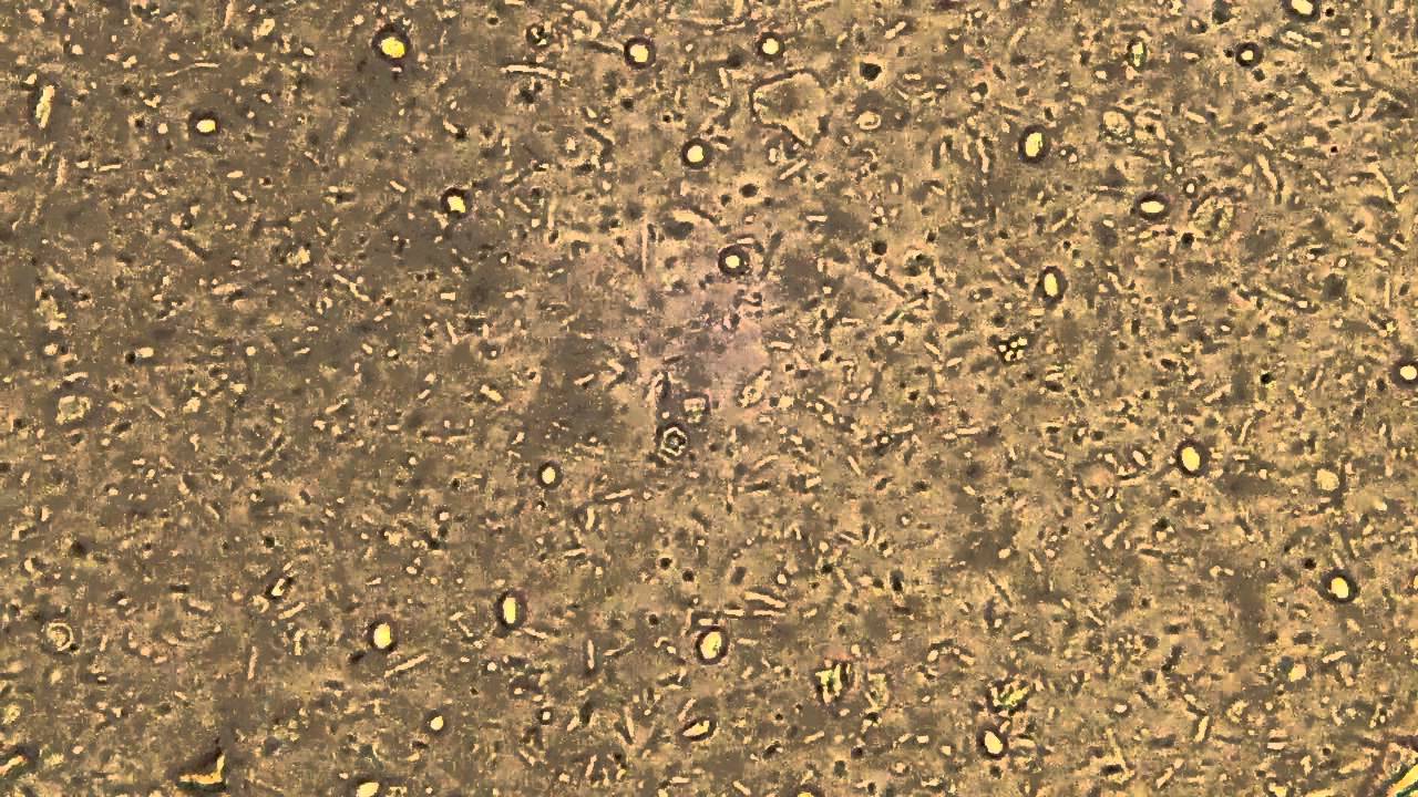 Espiroquetas en copro de cachorra de raza Xolo de nombre Ramona - YouTube