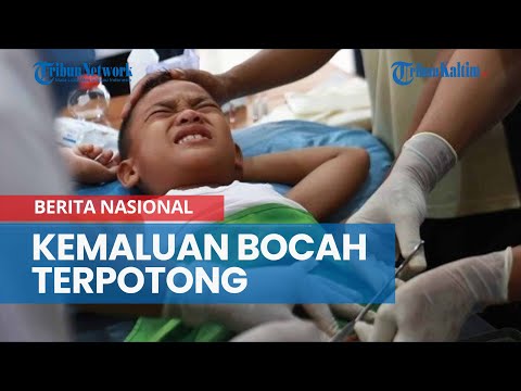 Kemaluan Bocah Terpotong Saat Sunatan Massal di Riau