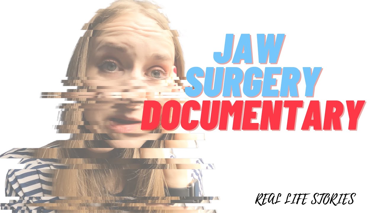 Jaw Surgery Documentary: Real Life Stories - YouTube