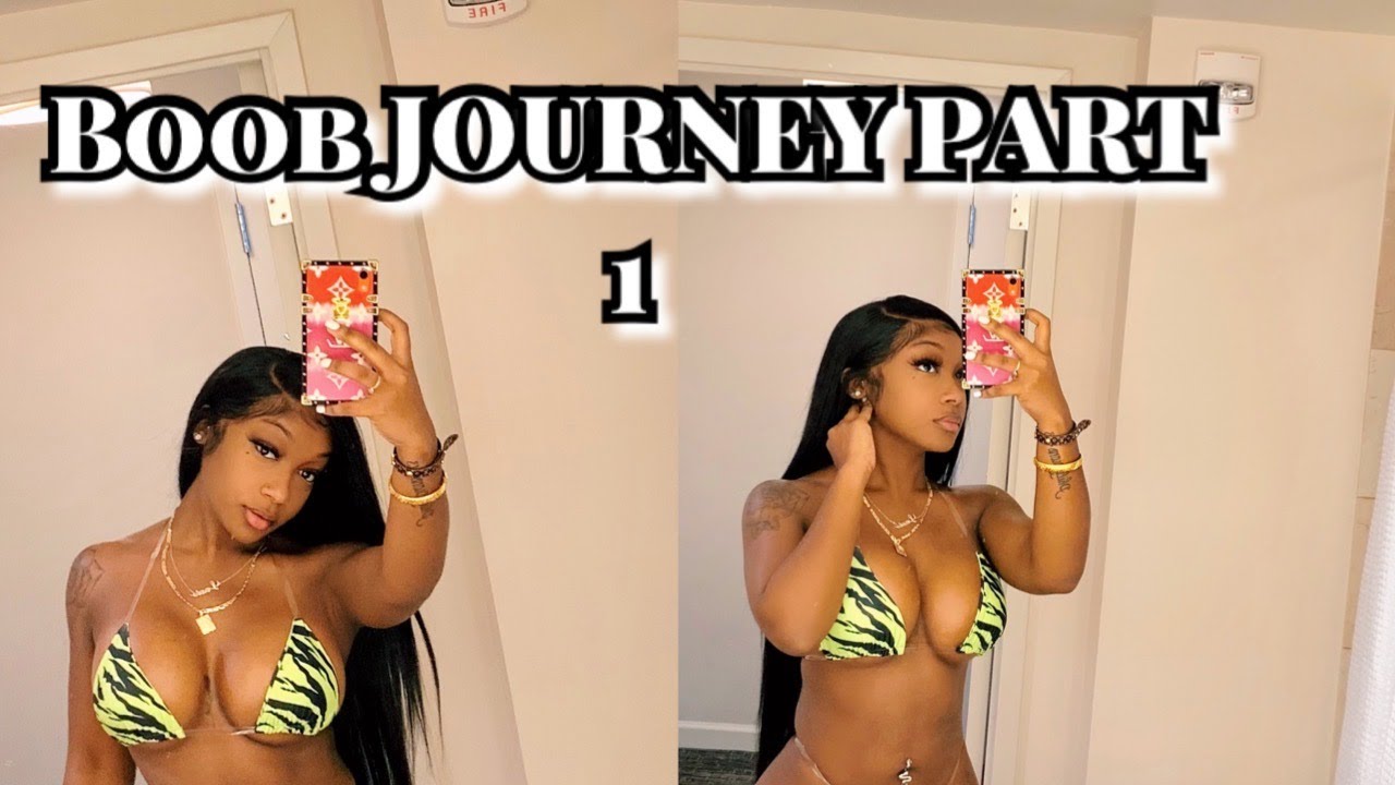 Vlog Breast Augmentation Boob Surgery Part 1 Youtube