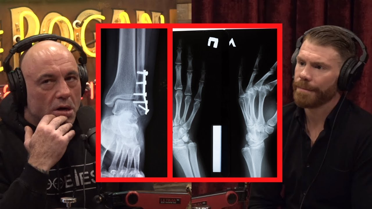 Scary Injuries From MMA Fights - YouTube