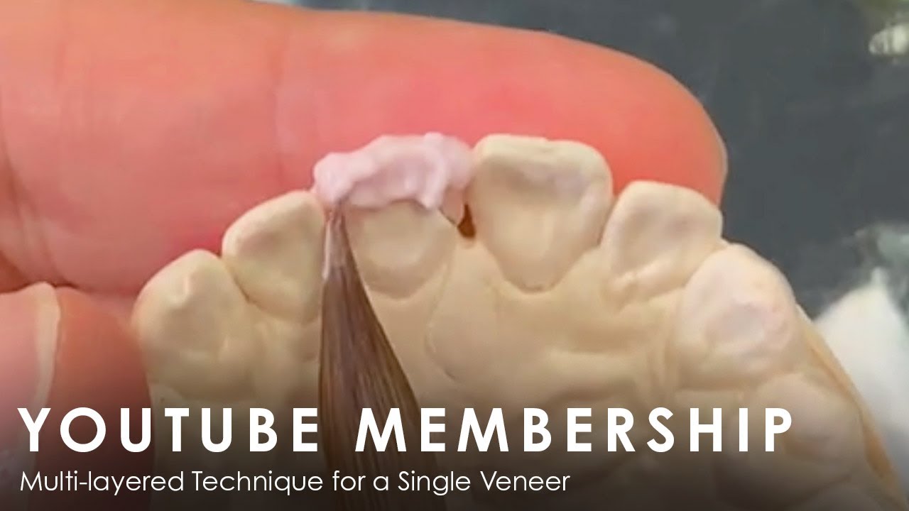 Multi-layered Technique for a Single Veneer - YouTube