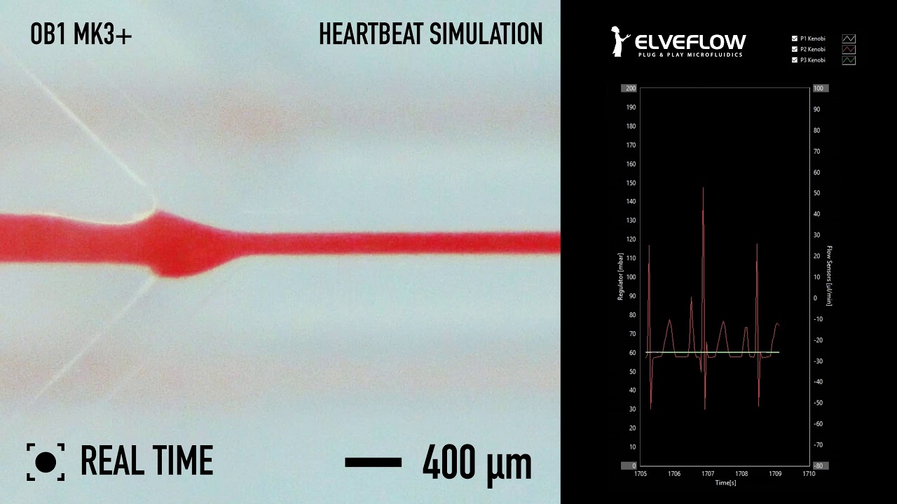 Microfluidic blood flow behaviour with hydrodynamic focusing using Elveflow OB1 pressure ...