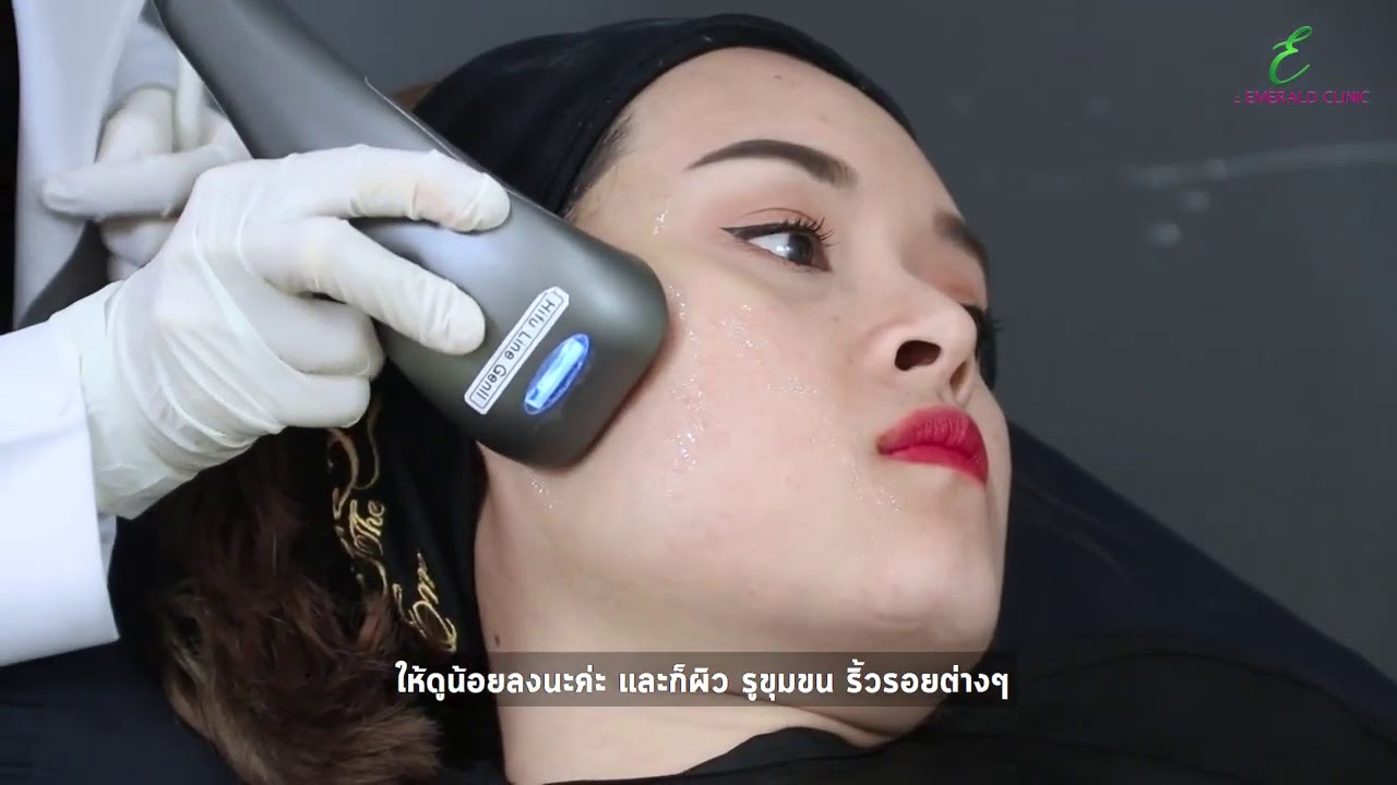 Sygmalift at Emeral Clinic, immediate results lifting and skin glow ...