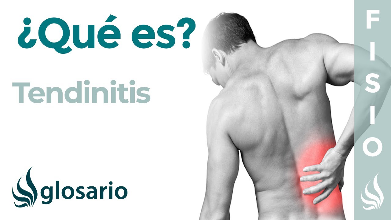 TENDINITIS | Qué es, qué estructuras afecta, síntomas, signos, causas y ...