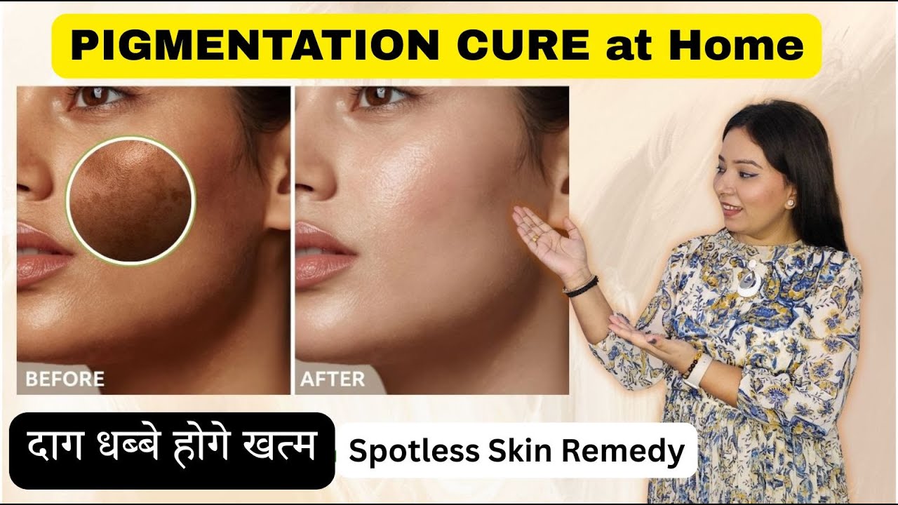 Pigmentation Cure Naturally | Unique DIY Mask for Dark Spots # ...