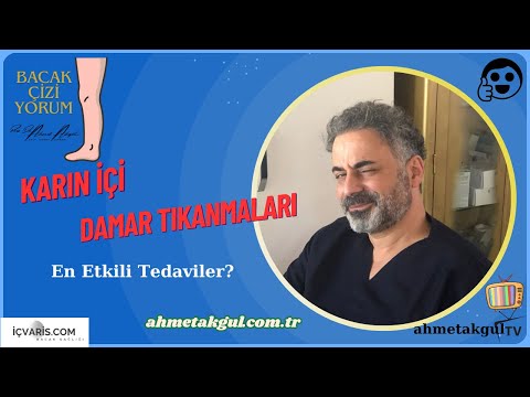 Bağırsakları Besleyen Damarın Tıkanması (Mesenterik İskemik) - Prof. Dr. Ahmet AKGUL