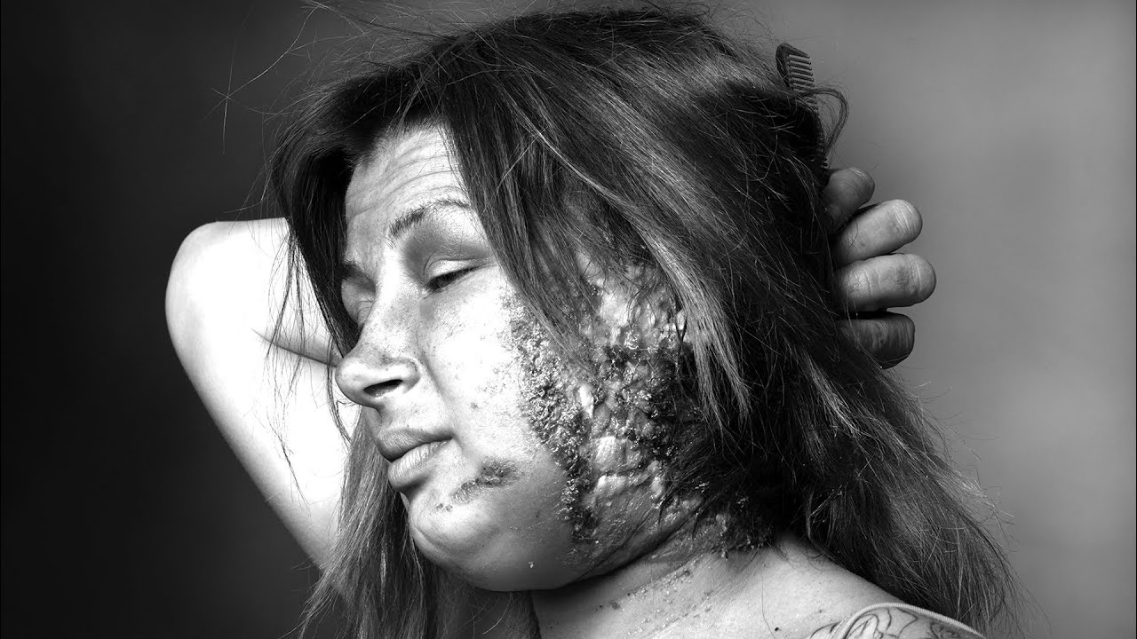 Bubonic Plague On Skid Row-Princess (2025 update) - YouTube