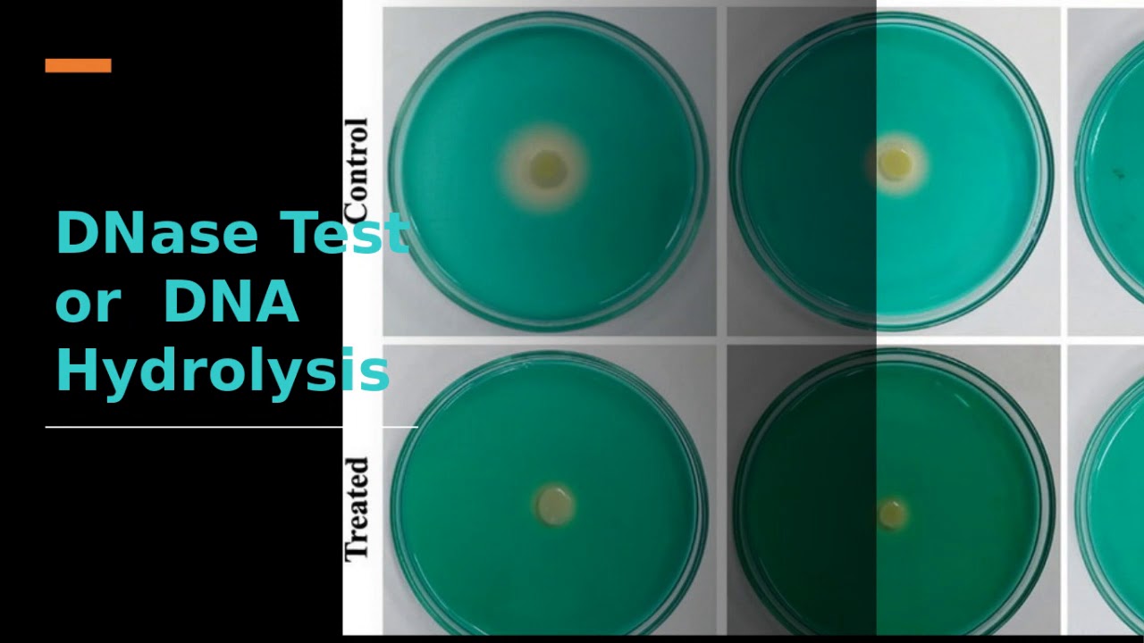 2420 Biology Lab Gelatin Hydrolysis, DNA Hydrolysis and Lipid ...