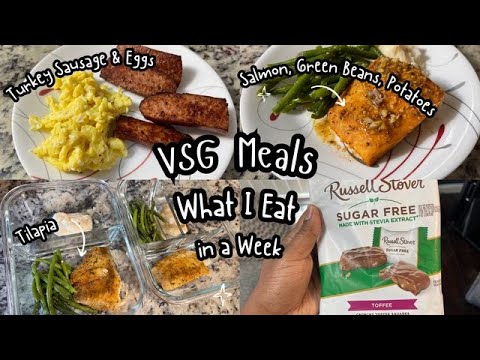 VSG Journey | I HIT A STALL | BARIATRIC SURGERY | GASTRIC SLEEVE | VSG ...