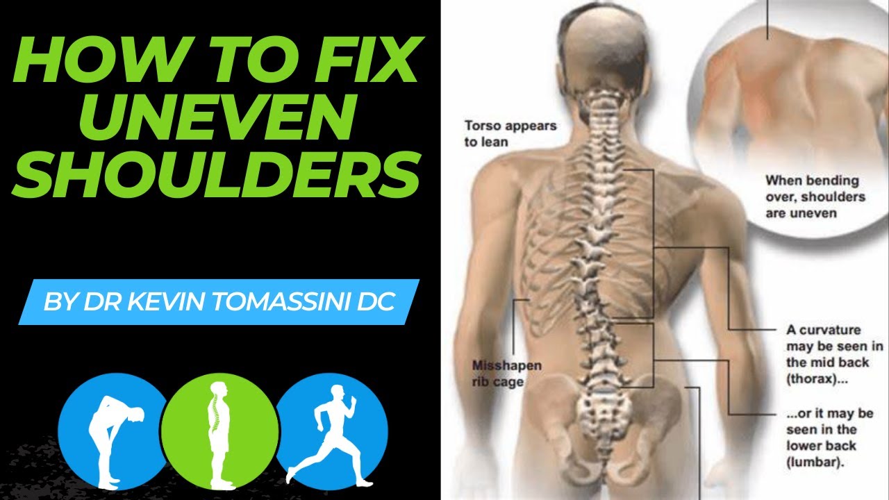 How To Fix An Uneven Shoulder - YouTube