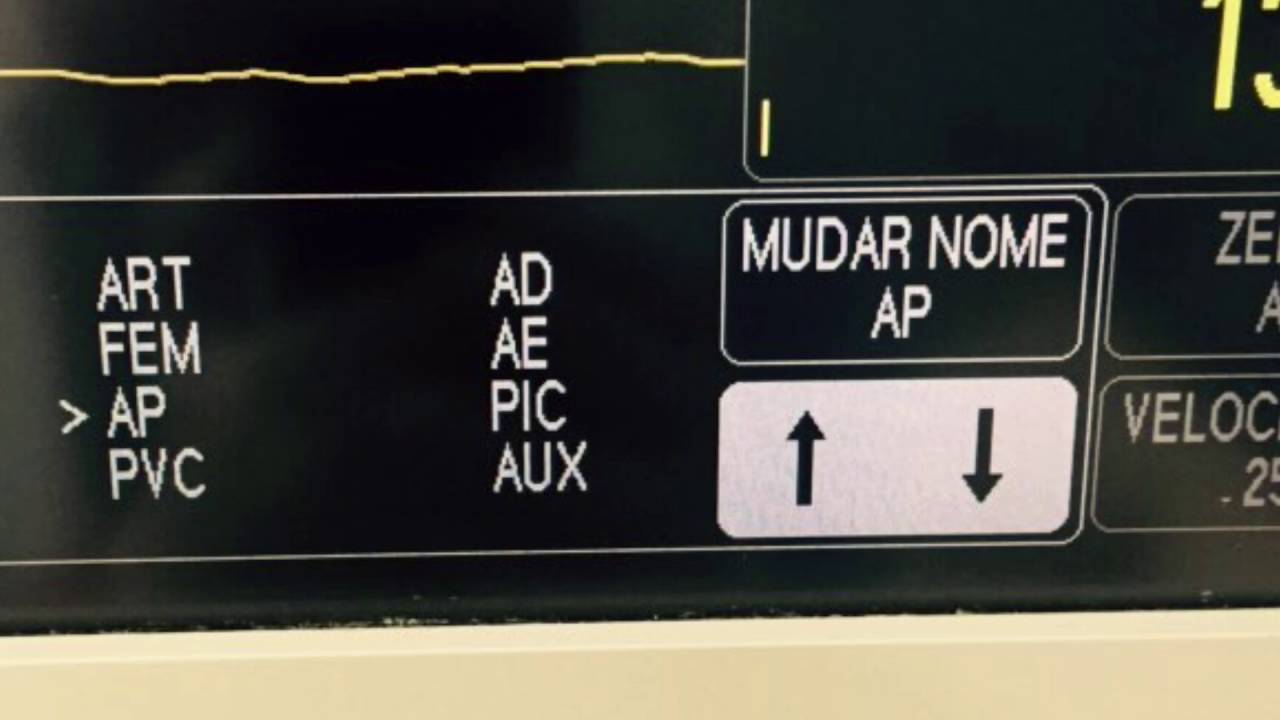 Delta PP como calcular - YouTube