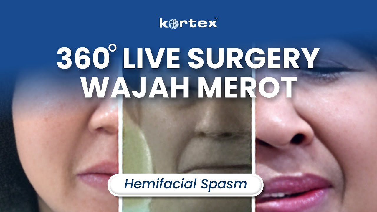 360⁰ LIVE SURGERY WAJAH MEROT - YouTube