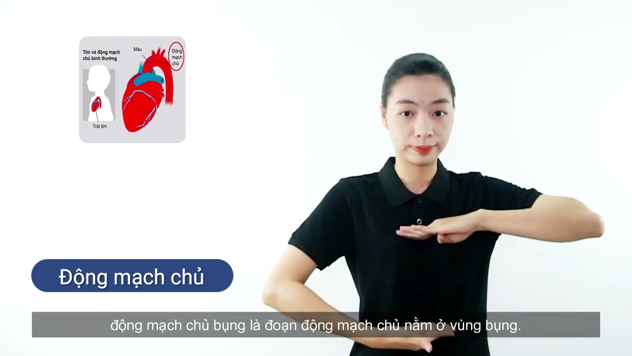 Video 29 Động Mạch Động Mạch Chủ Tĩnh Mạch Xơ Vữa động Mạch Đặt Stent Mạch Vành Youtube