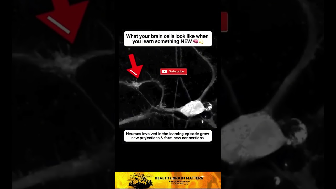 Watching the Brain Learn! 🧠📚 Neural Ultrasound in Action - Go IT