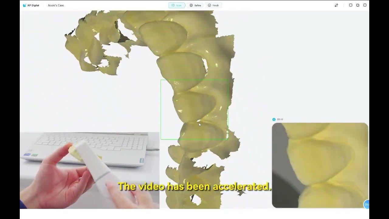 SmileScan-Scan tutorial - YouTube