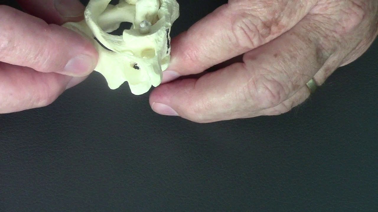 After NUCCA or Atlas Orthagonal Adjustments Treat This Motion - YouTube