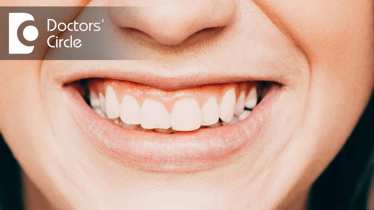 How do I know that I grind my teeth in the night? - Dr. Raju Srinivas ...