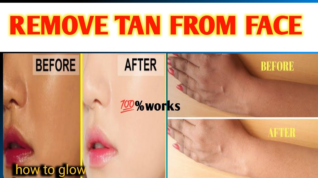 How To Remove Tan At Home Naturally|How To Glow Naturally| Makeup queen ...