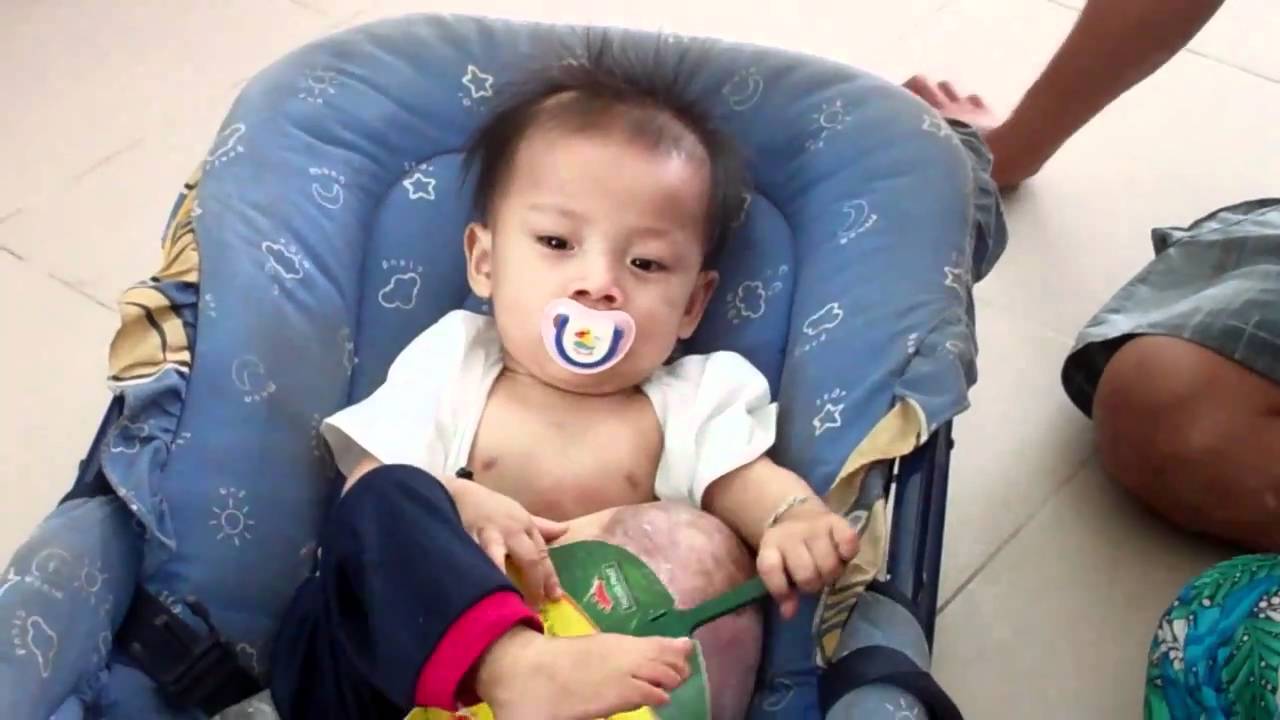 Tuan Anh in hospital waiting for Dr. Martin Corbally to check him out ...