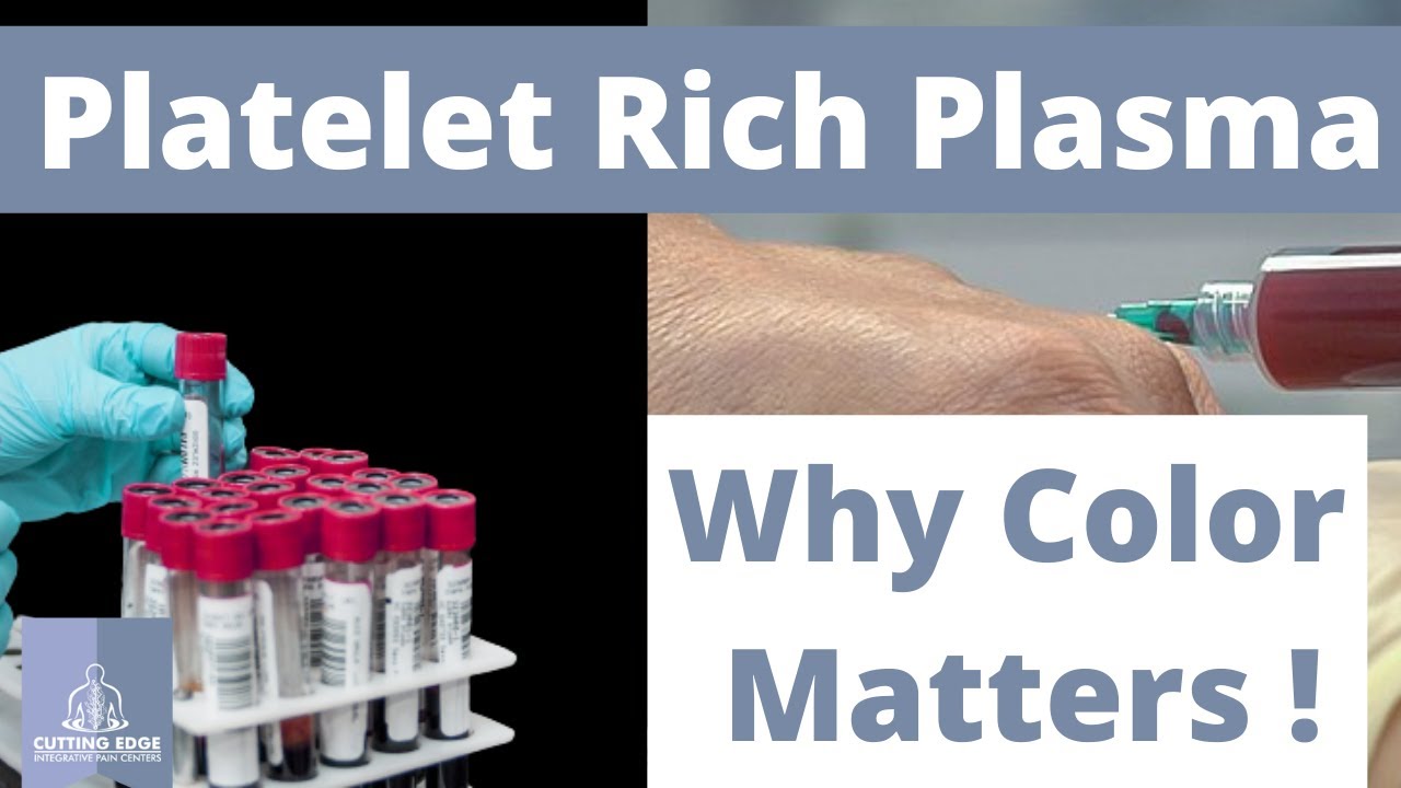 Why The Color of PRP Can Affect Whether You Get Better ! - YouTube