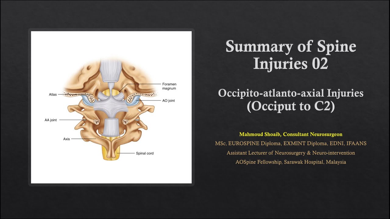 Summary of Spine Injuries 02 - Occipito-atlanto-axial Injuries - YouTube
