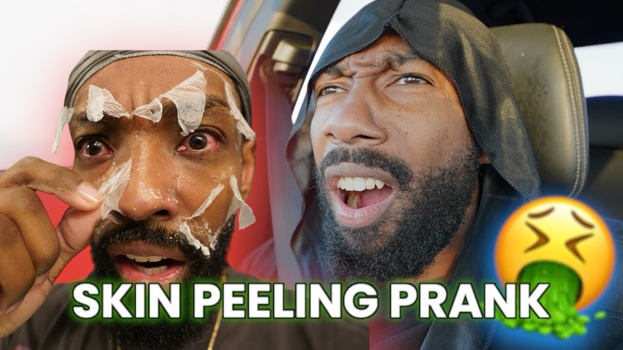 DISGUSTING SKIN PEELING PRANK ON MY BROTHER! | VLOGMAS DAY 11 - YouTube