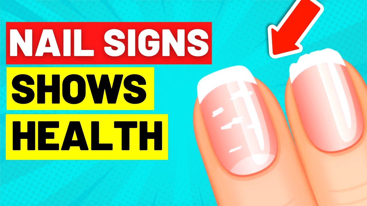 5 Surprising Ways Your Nails Show Your Health - YouTube