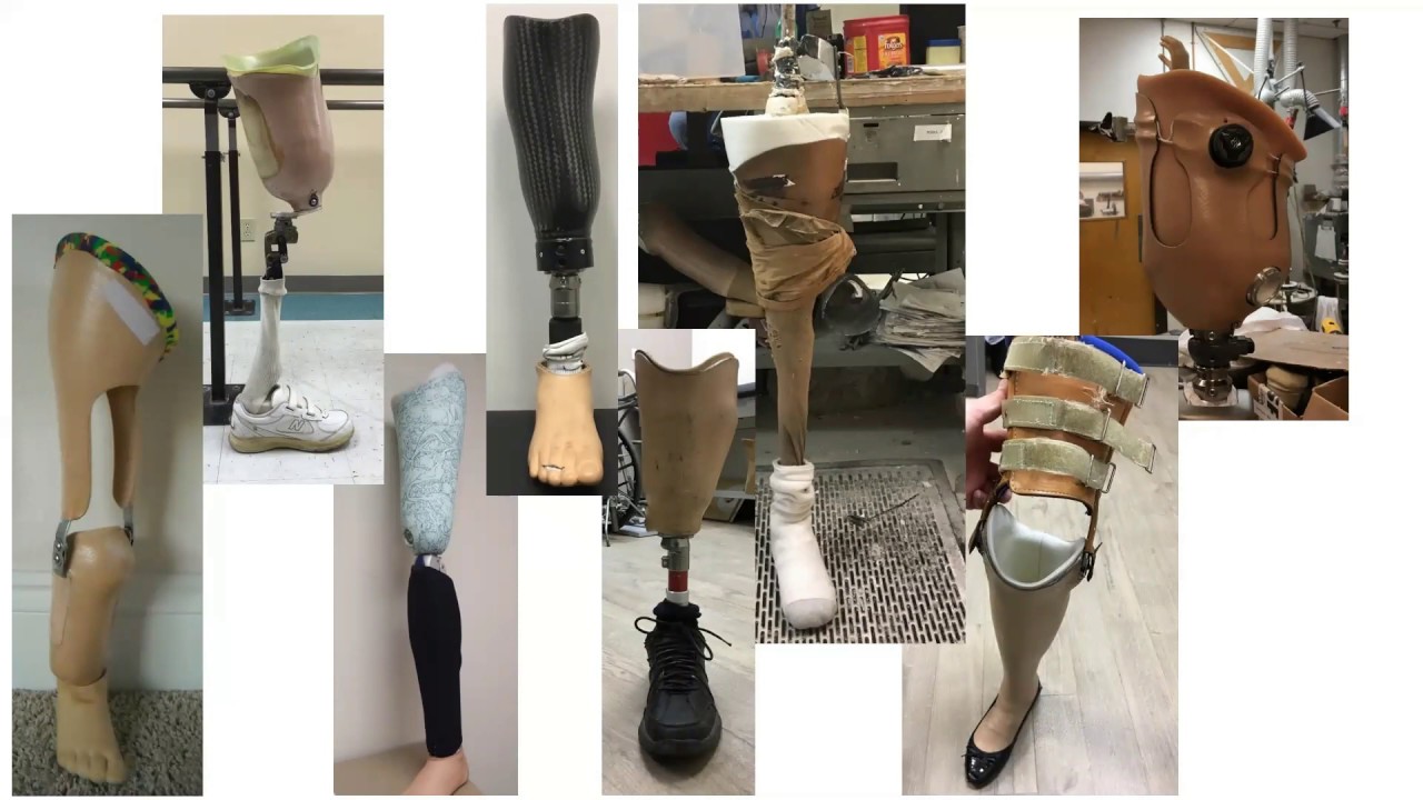 WEBINAR: ST&G Material Selection for Prosthetic Socket - YouTube