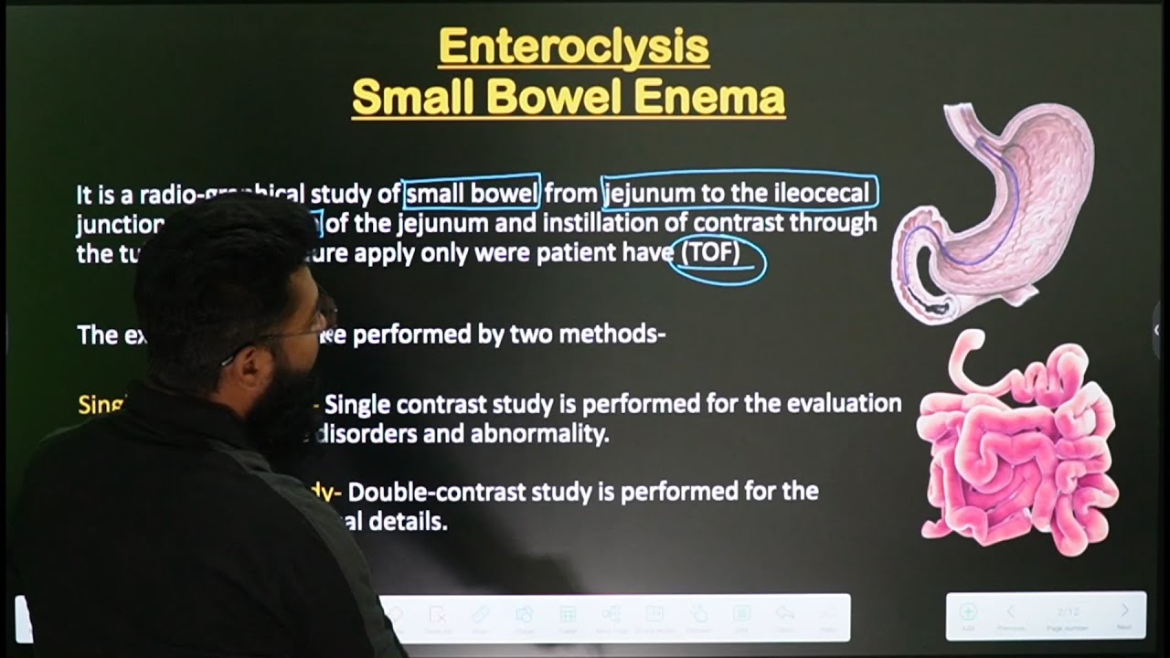 Small Bowel Enema || Enteroclysis Procedure || Part-1 || In Hindi ...