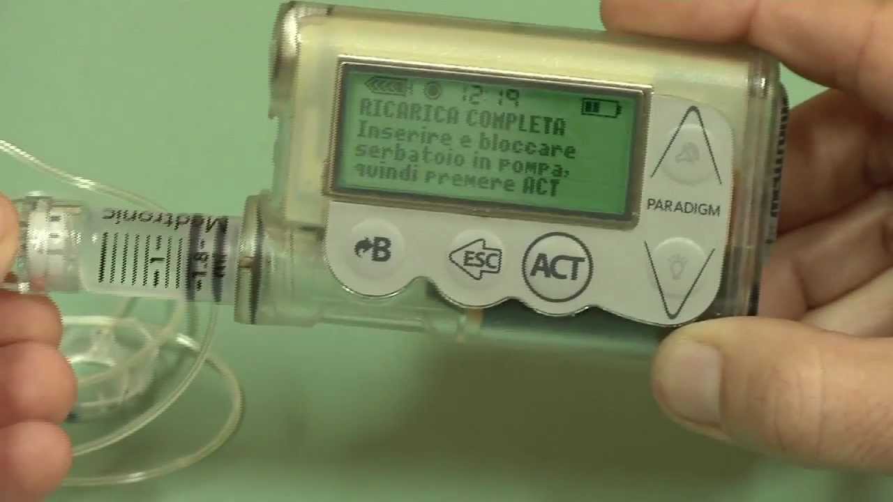 Guida all'uso del Microinfusore 1 - YouTube