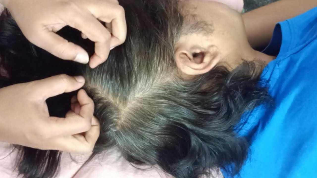 The Science of Relaxation: ASMR Scalp Check - YouTube