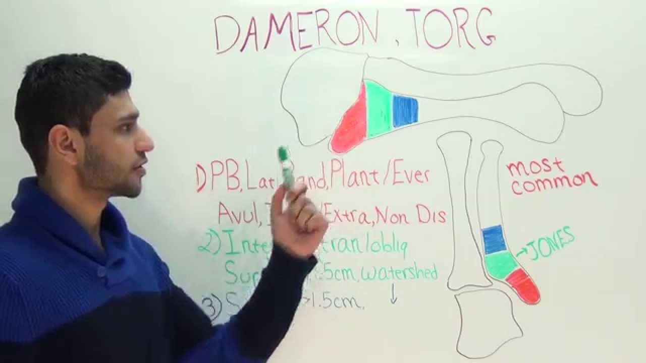 Dameron and Torg 5th metatarsal fracture classification - YouTube