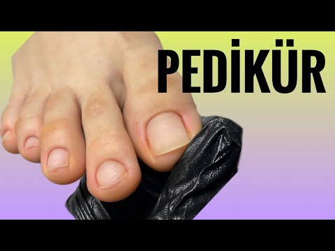 Pedikür nasıl yapılır ? Medikal pedikür yapımı