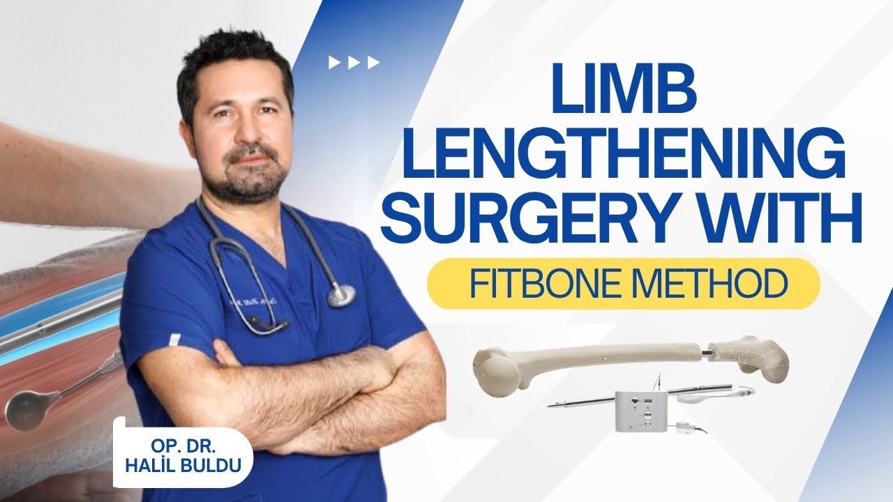 LIMB LENGTHENING SURGERY WITH FITBONE METHOD - YouTube
