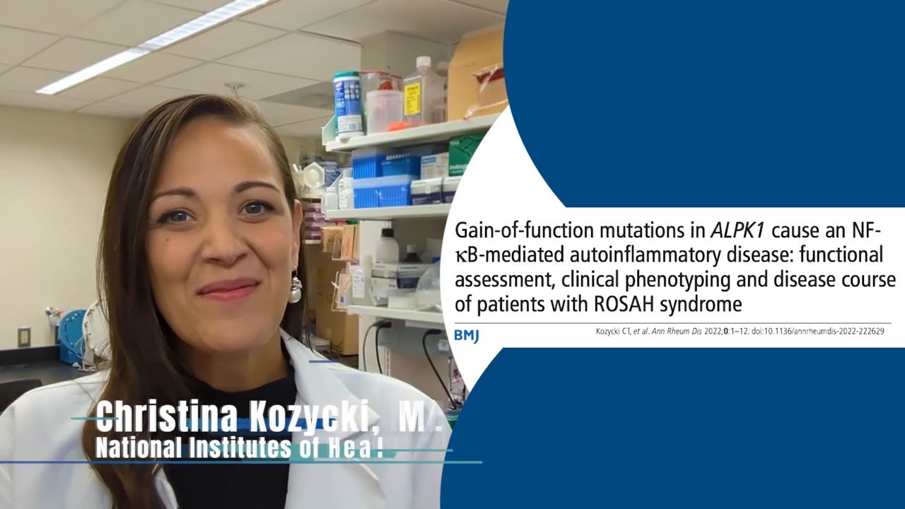 ROSAH syndrome is an autoinflammatory disease: Drs. Christina Kozycki ...
