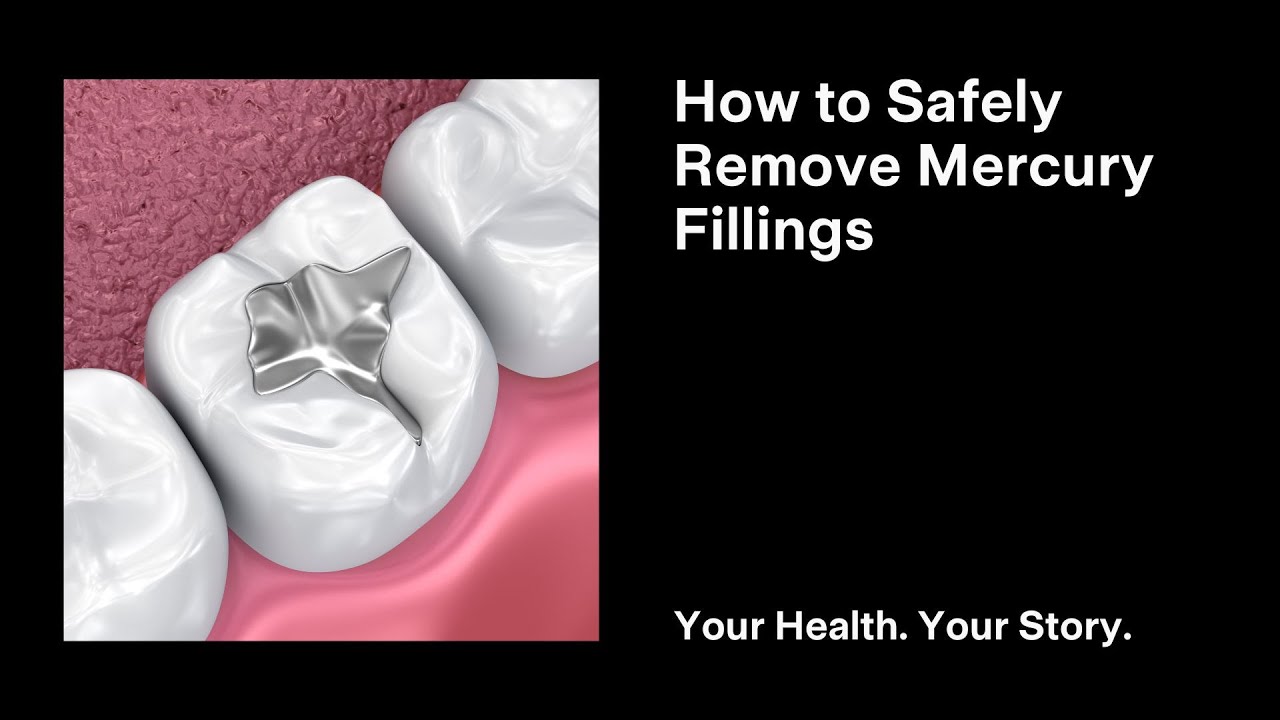 How to Safely Remove Mercury Fillings - YouTube
