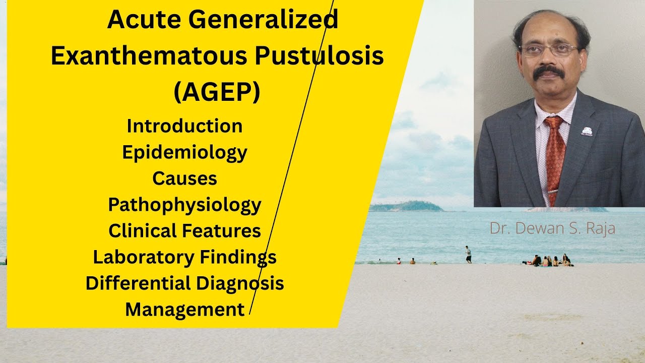 Acute Generalized Exanthematous Pustulosis (AGEP) - YouTube