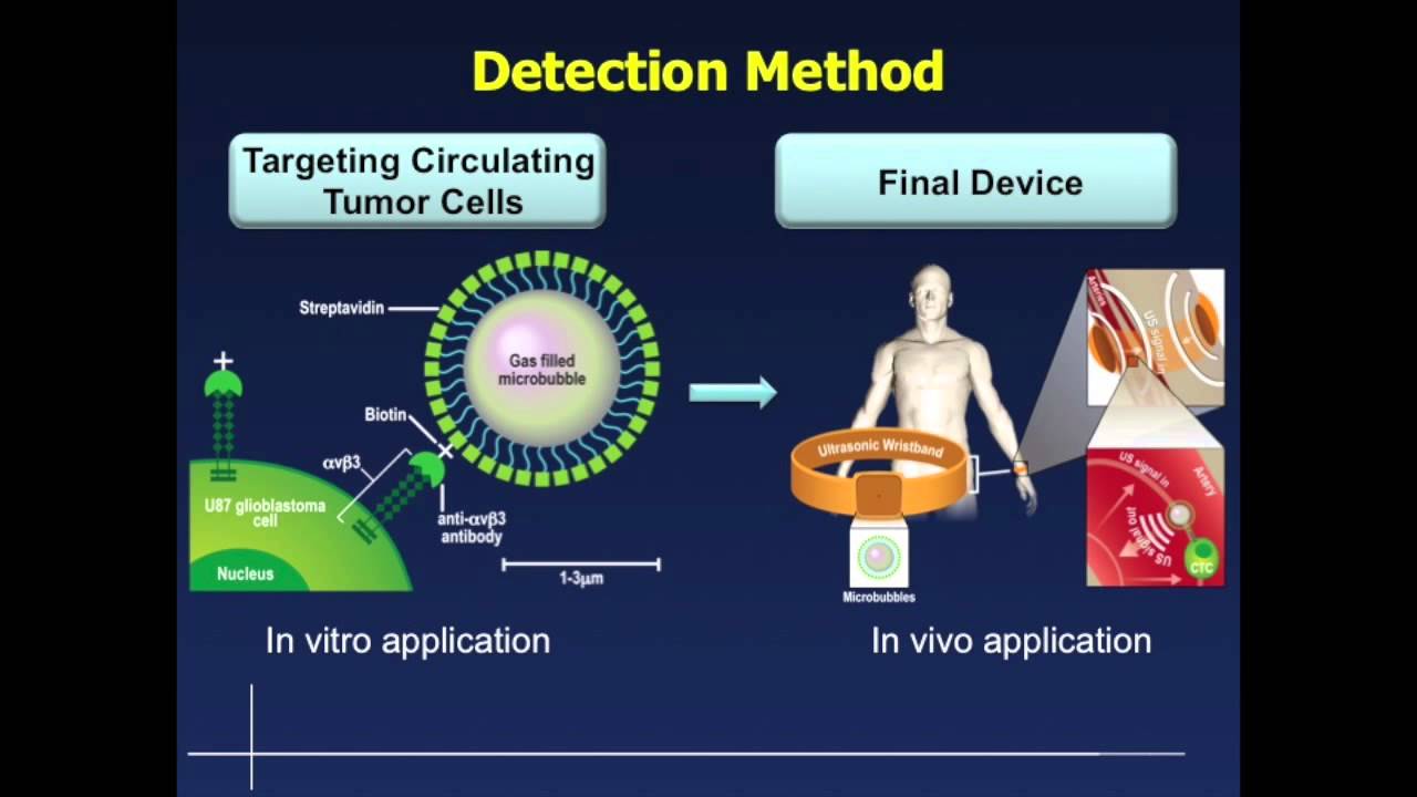 A Wearable Ultrasound Device for the Early Detection of Cancer ...