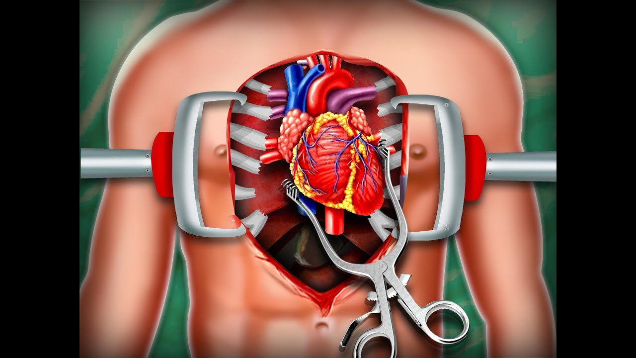 Heart surgery best asmr games - YouTube
