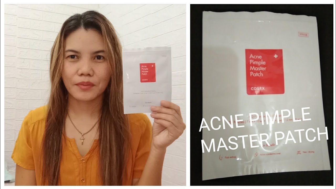 ACNE PIMPLE MASTER PATCH Effective ba mawala ang pimples? - YouTube