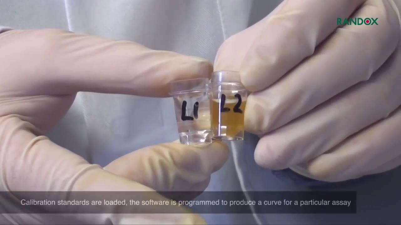 Liver Function Tests by an automated analyzer - YouTube